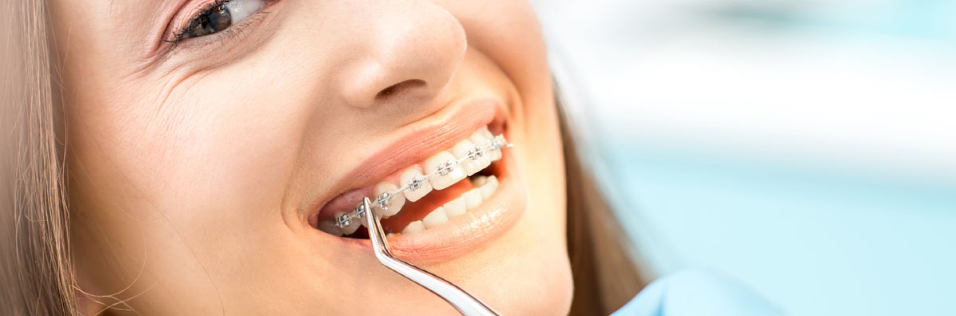 Orthodontiste à Paris 16 | Dr Emilie Fitoussi | Orthodontie de l’adolescent Orthodontiste à Paris 16 | Dr Emilie Fitoussi | Orthodontie de l’adolescent